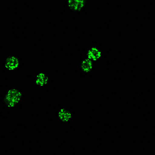 Moroy Laboratory – Research Unit on Hematopoiesis and cancer